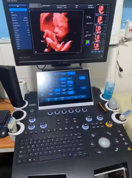 4D Color Ultrasound machine-数宝达科技